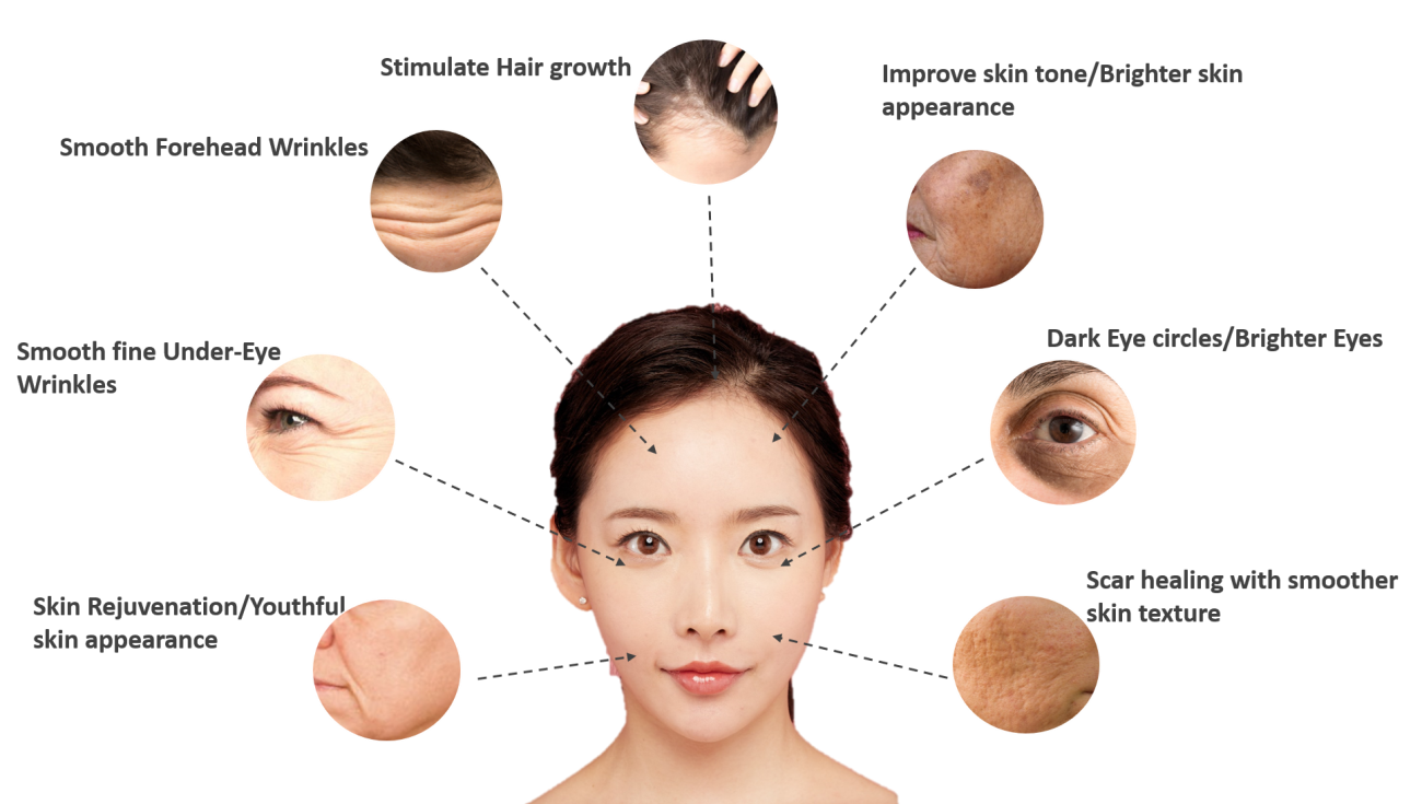 PRP Rejuvenation - Invivo Hospitals