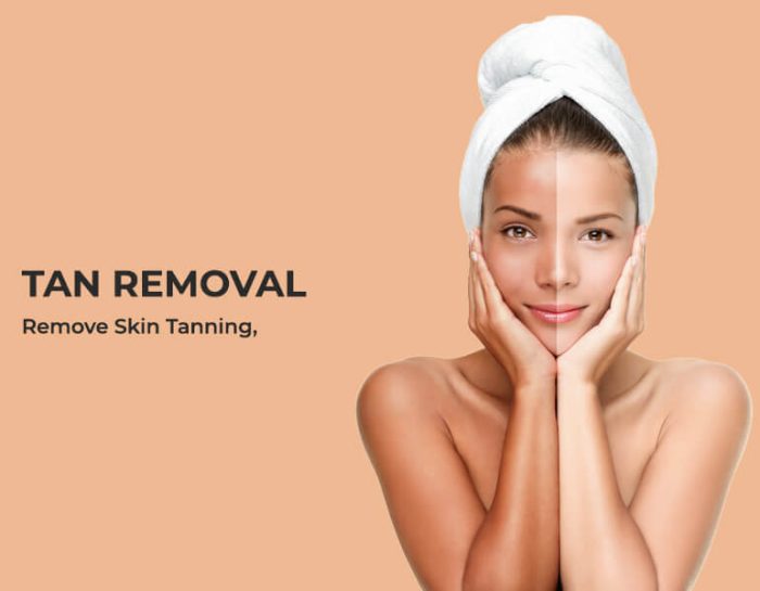 Skin Tanning / Pigmentation - Invivo Hospitals