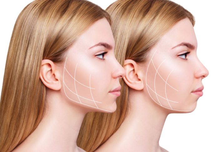 Jawline Definition - Invivo Hospitals